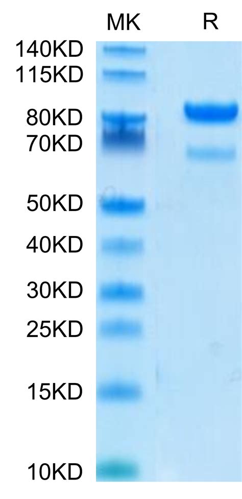 Human Ror2 Ntrkr2 Protein Recombinant Reprokine