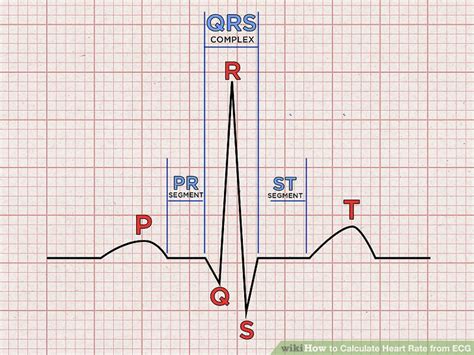 How To Calculate Heart Rate From Ecg 8 Steps With Pictures