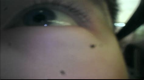 Datasetpupildetectionv2 Object Detection Dataset By Eyetracker