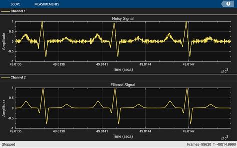 removing high frequency noise from an ecg signal matlab and simulink