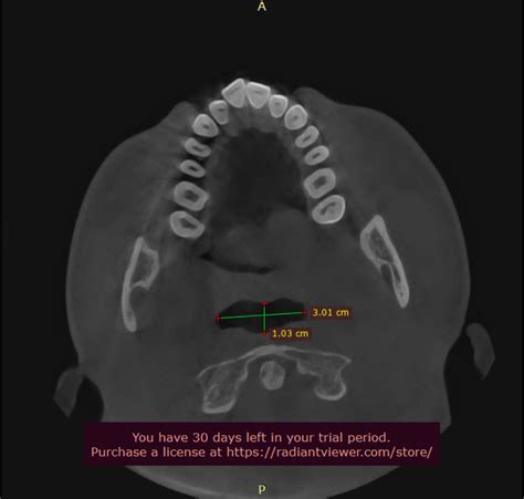 Self Analysis Using Dicom Data Rjawsurgery