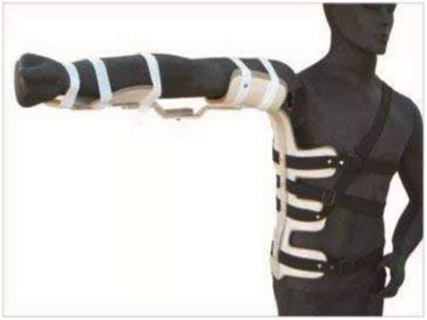 Various Types Of Splints And Basics PPTX