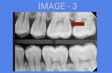 X Ray Classification Flashcards Quizlet