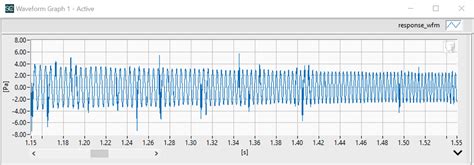A New Method For Transient Distortion Detection Speaker Related