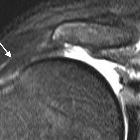 8 This Patient Was Investigated With Magnetic Resonance Imaging Mri