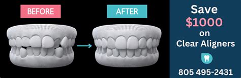 Evolution Of Clear Aligners From 1945 Tooth Positioner To Ai Driven