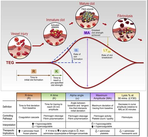 Anesthesia Summary On Teg The Thromboelastogram Teg