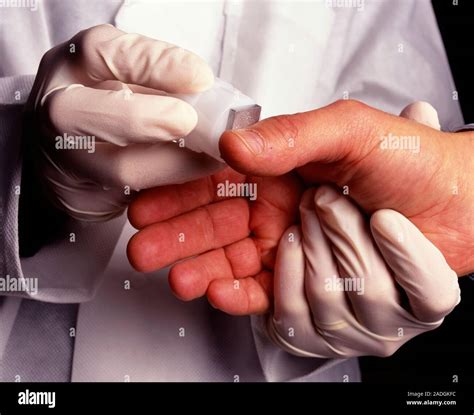 Looking For Gunshot Residue Gsr Gsr Stub Being Used To Sample A Suspects Hand Gsr Is