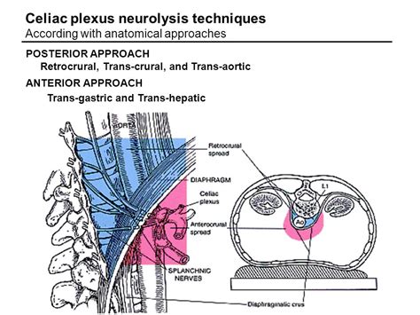 Celiac Plexus Anatomy