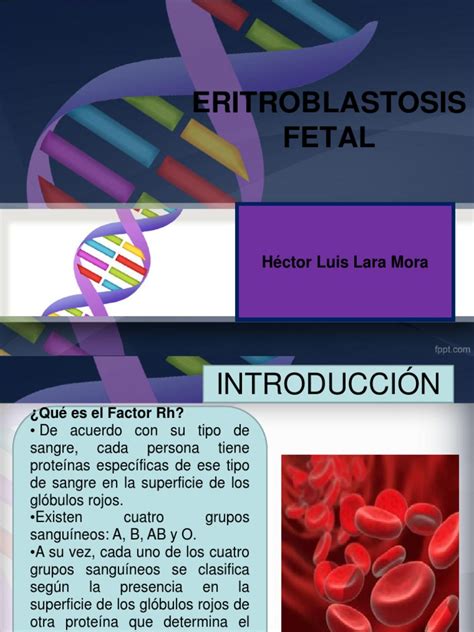 Eritoblastosis Fetal Pdf Tipo De Sangre Sangre