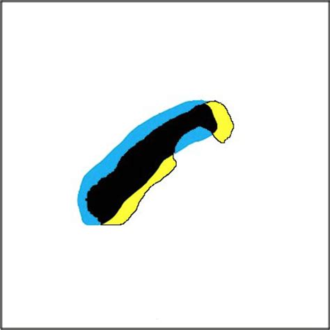 An Illustration Of True Positives Black Color False Positives Blue