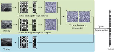 Ultrasound Image Texture Feature Learning‐based Breast Cancer Benign