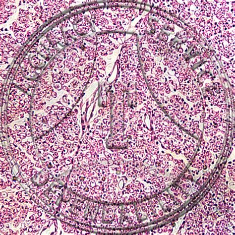 Peripheral Nerve Human Cs Prepared Microscope Slide