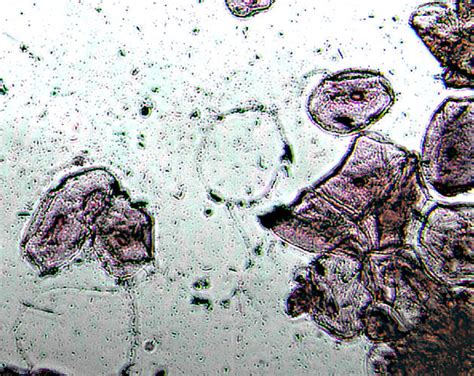 Correlative Imaging Of Cells