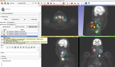 3d slicer dicom4qi