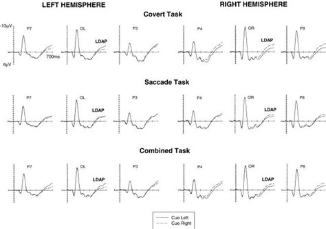 Grand Averaged Erps Elicited During The Cuetarget Interval In The