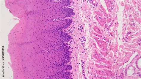 Stratified Squamous Epithelium Filmed By Microscope With 200x Against