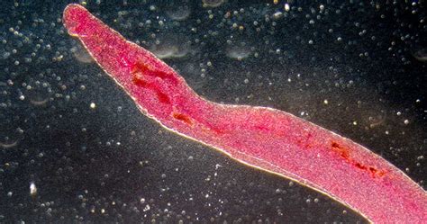 Parasitic Flatworms In Humans