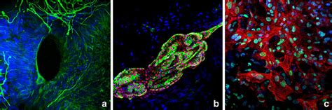 In Vitro Differentiation Of Es[11 Em] Of Ectoderm Endoderm And Download Scientific Diagram