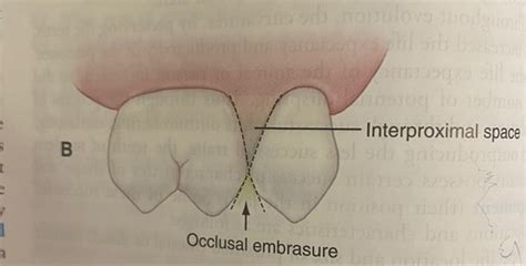Dental Anatomy Test 2 Flashcards Quizlet
