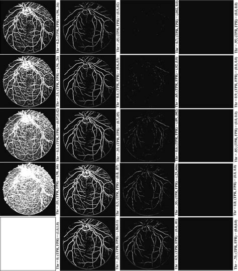 Binary Vessel Segmentation From A Phase Congruency Image For Different