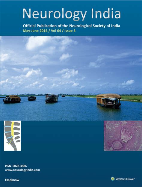 Pdf Unilateral Asterixis A Useful Lateralizing Neurological Sign