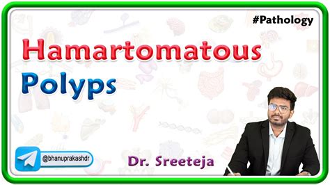13 Hamartomatous Polyps Hps Usmle Step 1 Pathology Youtube