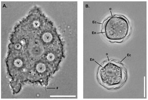 Acanthamoeba Histology