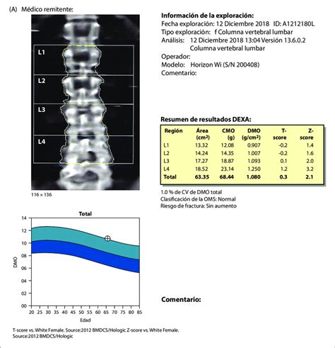 Densitometry Results In December 2018 1 Year After The Start Of