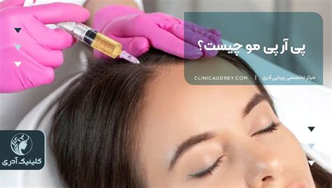 Prp مو چیست؟ قطع ریزش مو و رویش مجدد هزینه 1404