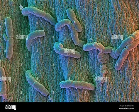 Bacillus Cerus Bacteria Coloured Scanning Electron Micrograph Sem Of