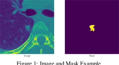 Figure 1 From Use Of Convolutional Neural Networks For Detection And Segmentation Of Pulmonary