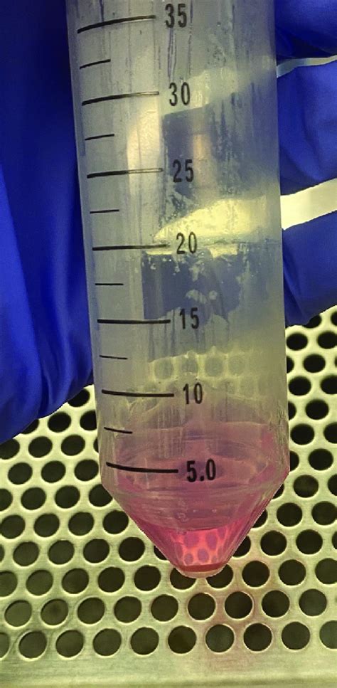 Depiction Of Cell Pellet After Step 21 Immune Cell Pellet After Ack