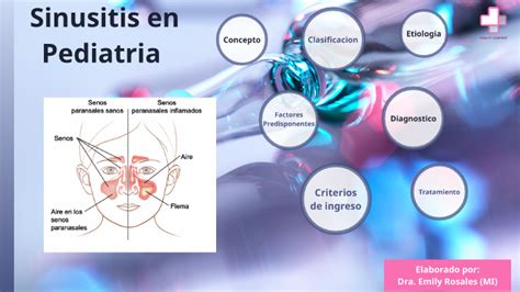 Sinusitis Pediatria By Emily Rosales Rivera On Prezi
