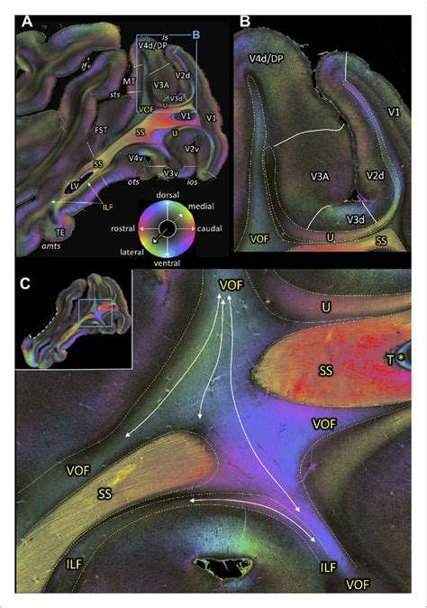 Fiber Orientation Maps Of Sagittal Sections Through The Left Hemisphere Download Scientific