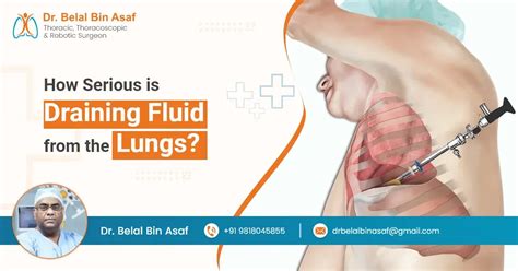 How Serious Is Draining Fluid From The Lungs Dr Belal Bin Asaf