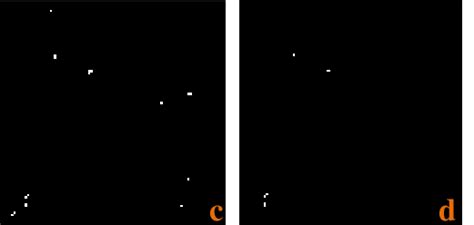 Results Obtained With The Algorithm For Automatic Microcalcification Download Scientific