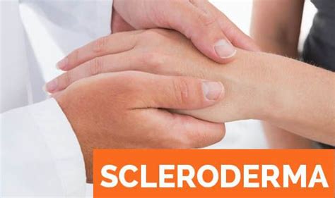 Types Of Both Scleroderma Explanation Archives Planet Ayurveda