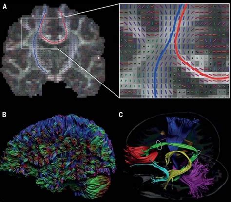 是时候重新认识人类大脑了！《科学》从“大脑连接”新角度带来全新洞见 知乎