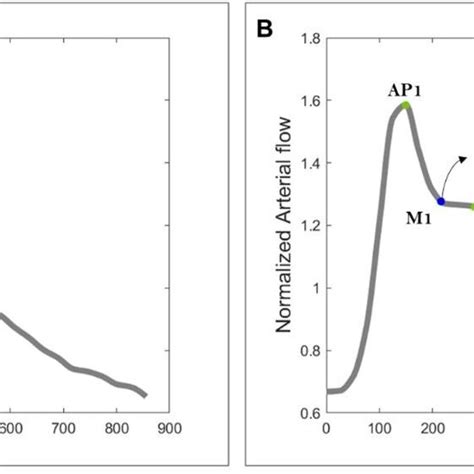 Main Representative Points Of The Arterial Flow Waveform Example Of An