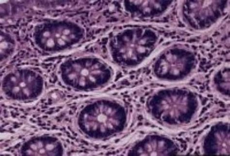 Novus Biologicals Colon Tissue Slides Normal Paraffin Colon Tissue