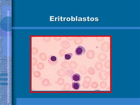 PPT Eritroblasto PowerPoint Presentation Free Download ID