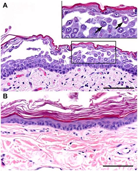 Histopathology Findings For Neonatal Puppies With Ectodermal Download Scientific Diagram