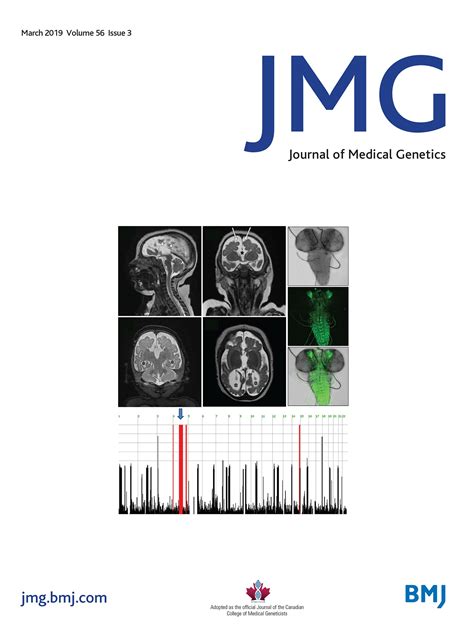 Molecular Genetic Classification In Prader Willi Syndrome A Multisite
