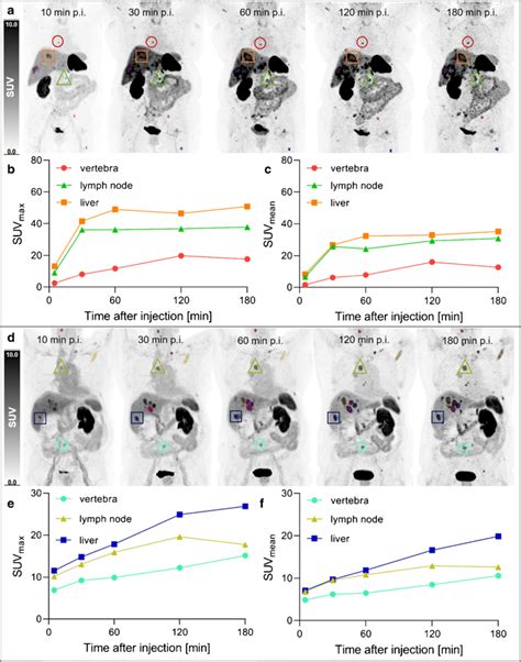 A D Exemplary Maximum Intensity Projection Images From All Scan Times