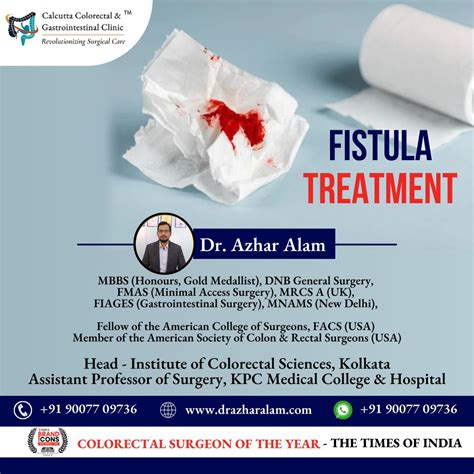 Dr Azhar Alam Laparoscopic And Laser Surgeon On Linkedin Piles