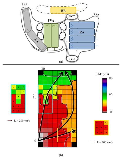 Method Of Epicardial Mapping A Mapping Scheme On A Schematic