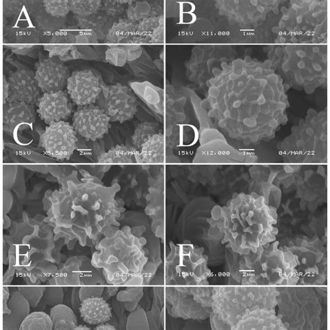 Basidiospores Of Four New Species In Sem A B R Brevispora Download Scientific Diagram