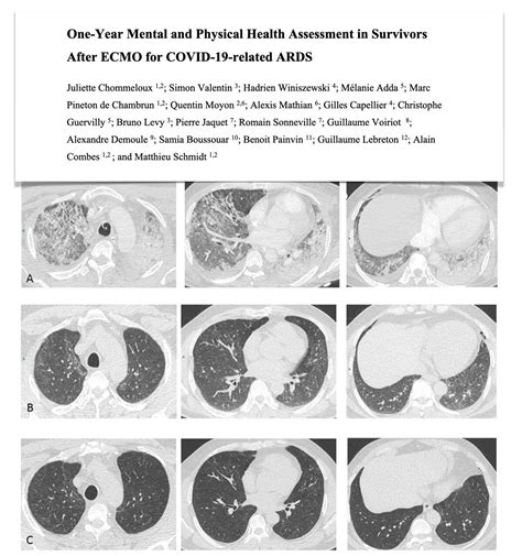 Elso The Extracorporeal Life Support Organization On Linkedin Ecmo
