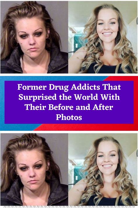 Pictures Of Crack Addicts Before And After